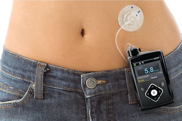 Infuzijski set MiniMed™ Quick set™ - Mediligo